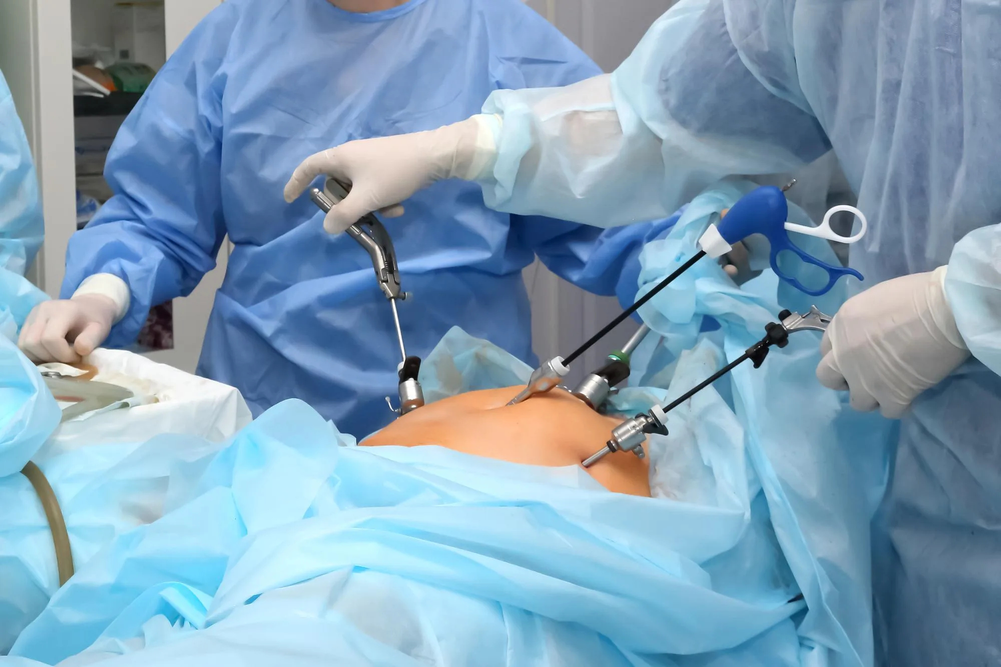 Storz Laparoscope Endo Technology storz-laparoscope-endo-technology
